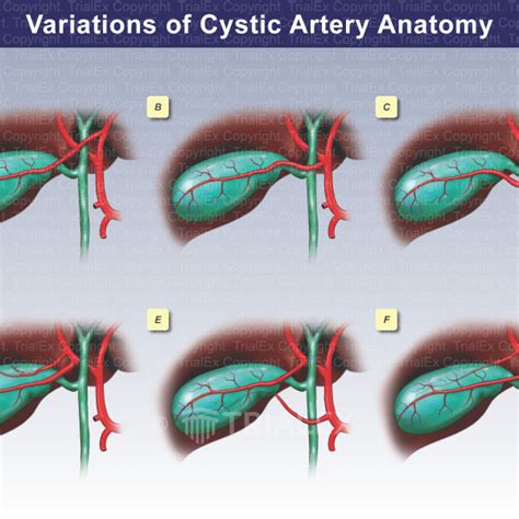 Variations Of Cystic Artery Anatomy Trialquest Inc