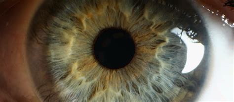 Geographic Atrophy Uk Homepage Apellis