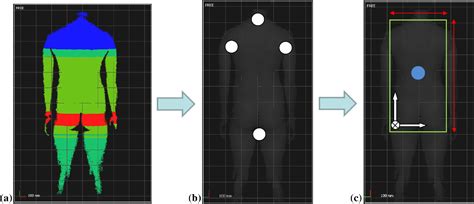 Figure 3 From Automatic Recognition Of Surface Landmarks Of Anatomical Structures Of Back And