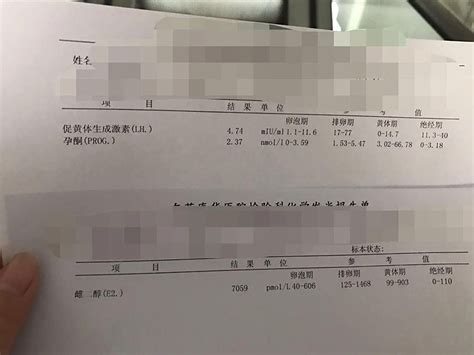 打夜针前18个卵泡雌二醇1800停针第二天降了300正常吗 WCOB