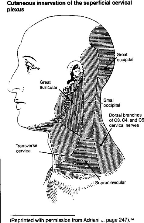 Cervical Plexus Block
