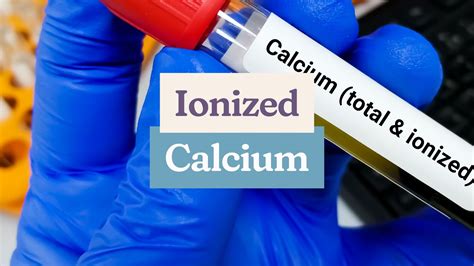 Ionized Calcium By Checkpoint Labs At Checkpoint Labs Home Service