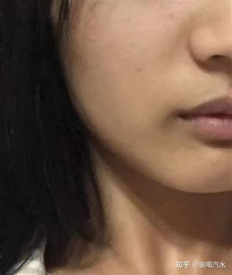 怎么能让皮肤变白？学会党怎么便宜的美白？ 知乎