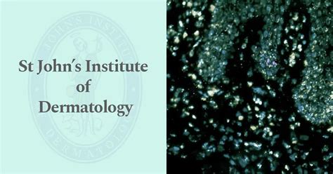 Non Allergic Urticarial Skin Reactions Associated With Mov18 Ige A