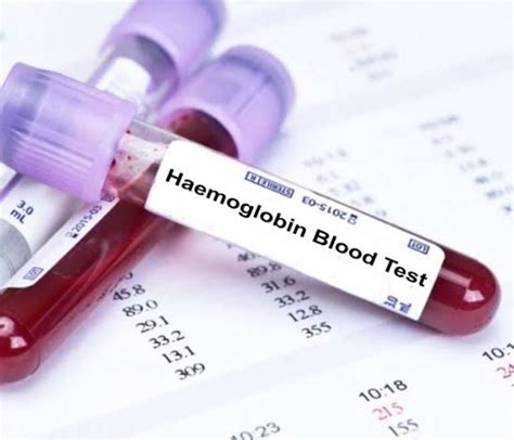 Hemoglobin Test