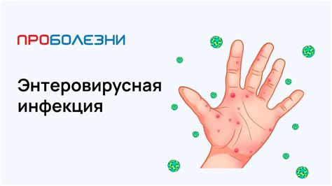 Энтеровирусная инфекция у детей