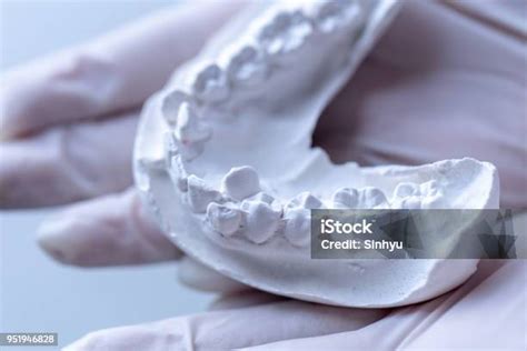 연구 진단 캐스트 및 치과 실험실에서 치과 석고 모델의 캐스팅 건강 진단에 대한 스톡 사진 및 기타 이미지 건강 진단 건강