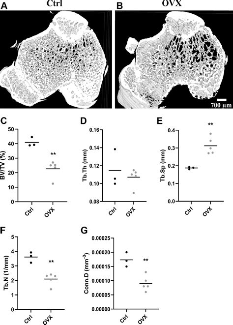 New Insights Into Immunoporosis The Impact Of Ovariectomy On Immune