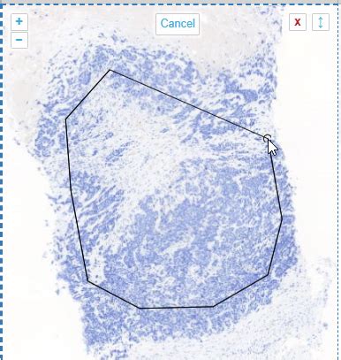 An In Depth Look At Polygon Annotations In PMA Studio Real Data Digital Pathology Blog