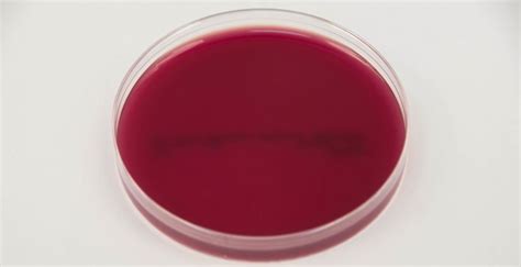 Agar Sangre Brucella Laked Ckanamicina Vancomicina As 112