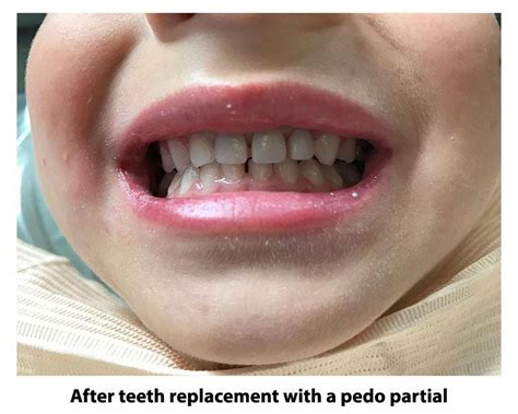 Smile Gallery Pediatric Dentist In Chicago Il