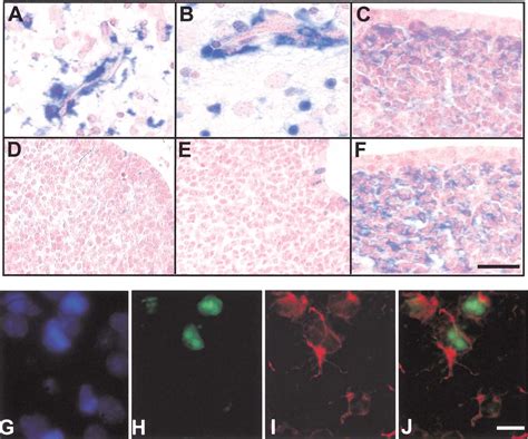 Figure 4 From Astrocyte Inactivation Of The Prb Pathway Predisposes Mice To Malignant