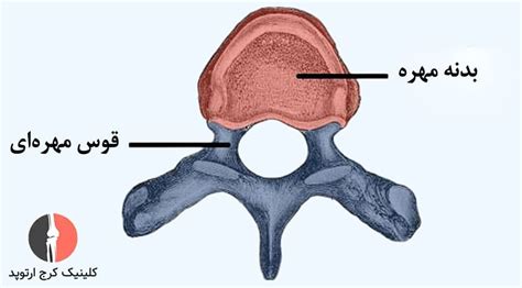 ستون فقرات، مهره‌های کمر و گردنعکس واقعی ارتوپد کرج کلینیک فوق تخصصی