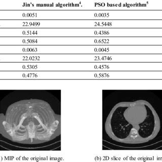 Four Metrics Obtained Using Three Different Segmentation Algorithms