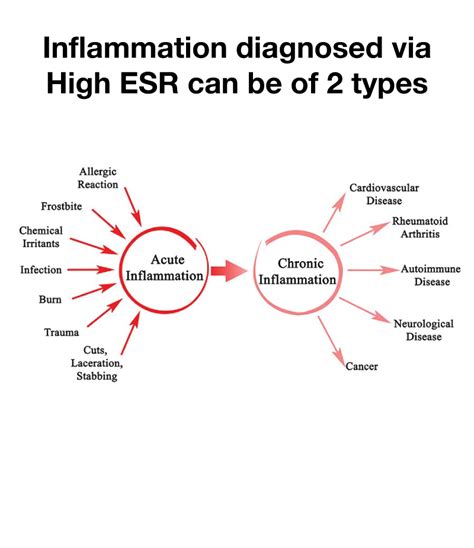 The Esr Result Decoded Your Health Status Revealed