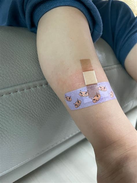 아기 접촉성 피부염 스테로이드 연고 부작용 없이 바르는 법 네이버 블로그