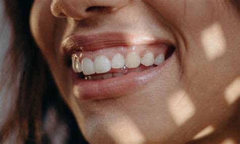 What Is A Gingivectomy Or Gum Reshaping Procedure