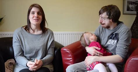 Family Has Baby With Treacher Collins Syndrome POPSUGAR Family