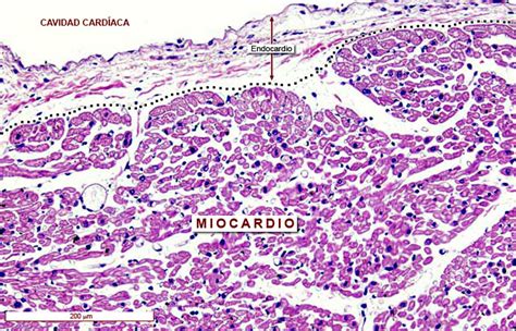 Miocardio