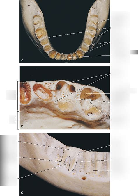 Dental Oral Histology And Embryology Chapter 14 Part 2 Alveolar