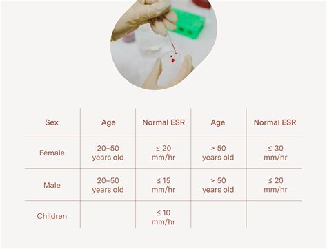 What Is A Normal Sed Rate For Rheumatoid Arthritis What You Need To Know