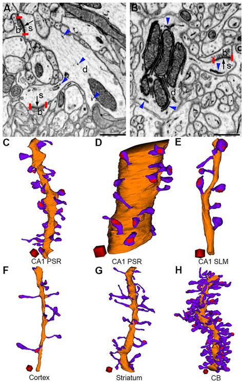 Dendritic Spines Learning