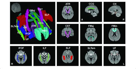 Major Anatomical Tracts Of The Brain Major Fiber Tracts Based On The