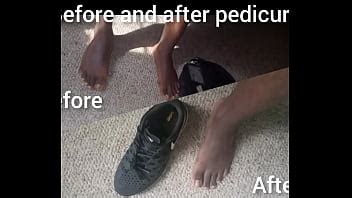 Before And After Pedicure Xvideos Com