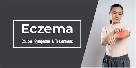 Get The Best Eczema Treatment In Bangalore