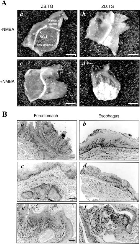 Figure 1 From Combined Cyclin D1 Overexpression And Zinc Deficiency