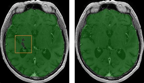 Example Of Holes In The Original Output Segmentation Left Image On Download Scientific
