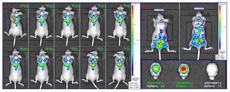 山西大学阴彩霞课题组jacs：“围猎 射击”新策略去甲肾上腺素快速、高特异性荧光探针将癫痫小鼠脑部信息可视化 X Mol资讯