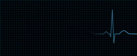 Ekg Ecg Simple Animation By Anty Art On Deviantart