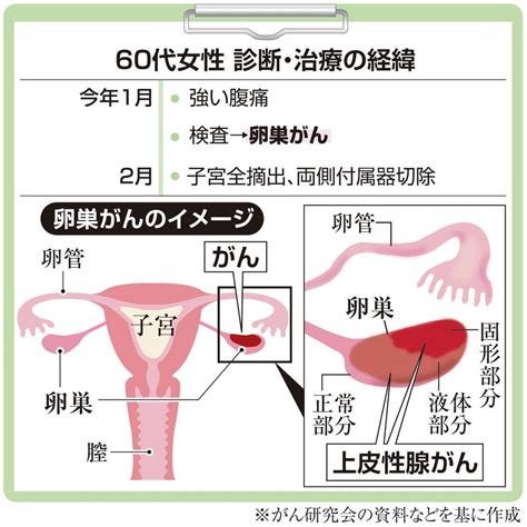 卵巣癌 JapaneseClass jp