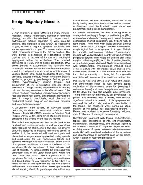 Pdf Benign Migratory Glossitis