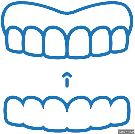 Aligners My Line Aligner