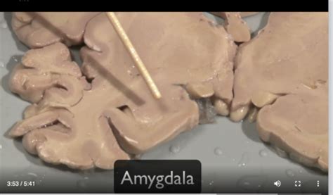 Emotion And Implicit Bias Flashcards Quizlet