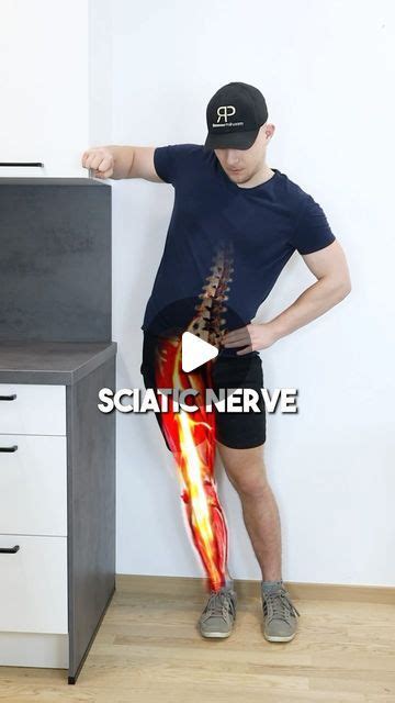 Recover Pain Online Pain Clinic On Instagram ⚡️ Sciatica