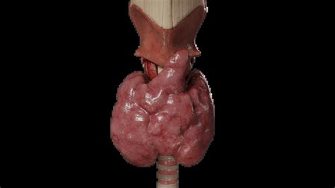 نماذج ثلاثية الأبعاد لتضخم الغدة الدرقية فوكا