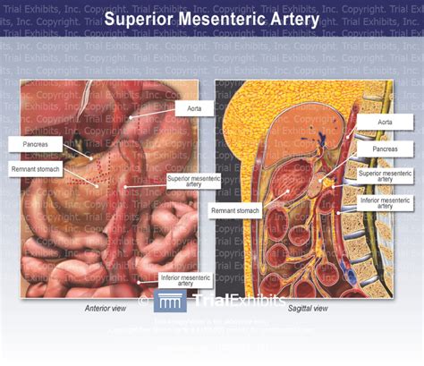 Superior Mesenteric Artery Trialquest Inc