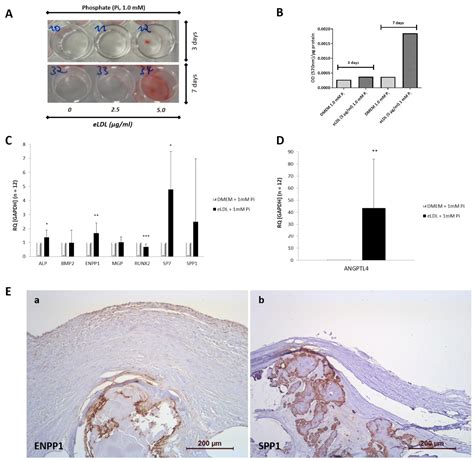 Pro Calcifying Role Of Enzymatically Modified Ldl Eldl In Aortic