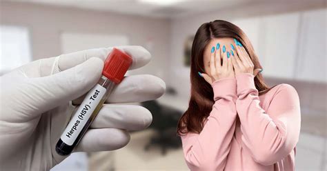 How Long Should I Wait To Get Tested For Stds