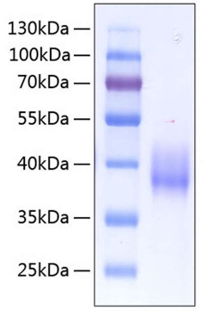 Recombinant Human Coagulation Factor Iiitissue Factorcd142 Protein