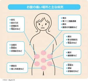 けんこう教室 お腹が痛いのですが 原 和人 石川城北病院 総合診療科 全日本民医連