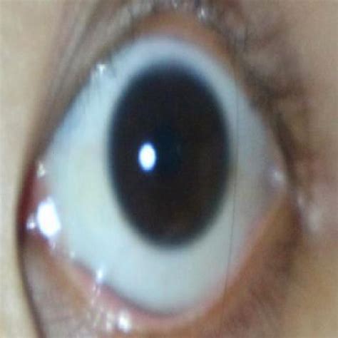 Yolov8 200 Classification Dataset By Crowdmanagement