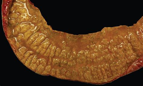 Infections By Clostridium Perfringens Type E Veterian Key