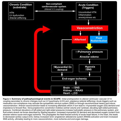 Sympathetic Crashing Acute Pulmonary Edema Scape Insight Into Pathophysiology And The Role Of