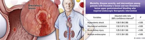 Dieulafoys Lesion Of The Upper Gi Tract A Comprehensive Nationwide