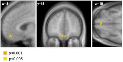 Neural Representation Of Experienced Utility Download Scientific Diagram