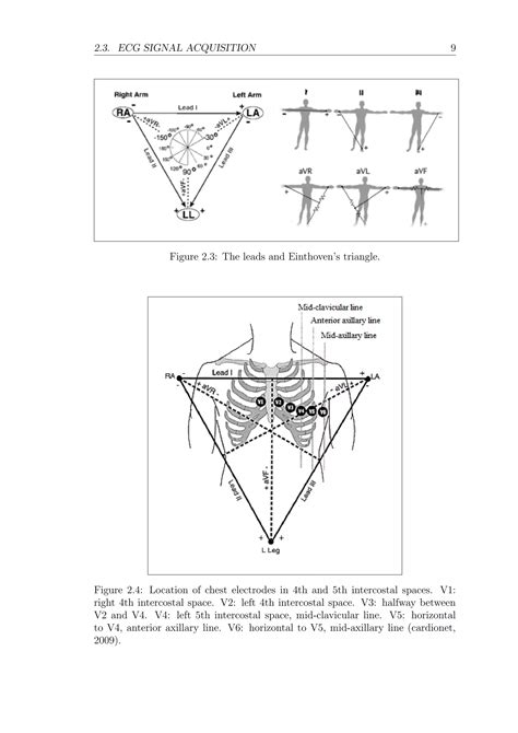 Analysis And Classification Of Ecg Signal Using Neural Network Pdf